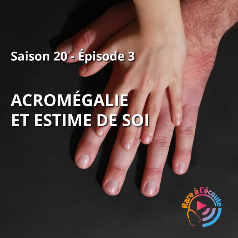 Acromégalie – Maladie Rare - Endocrinologie