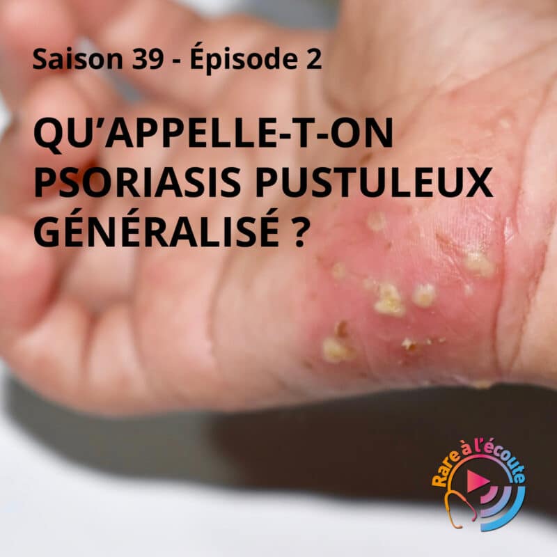 Psoriasis Pustuleux Généralisé – Maladie dermatologique