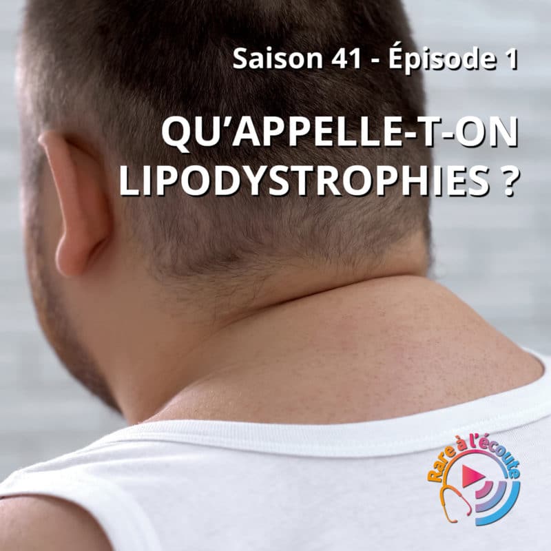 Lipodystrophies - Anomalie graisseuse - Maladie Rare